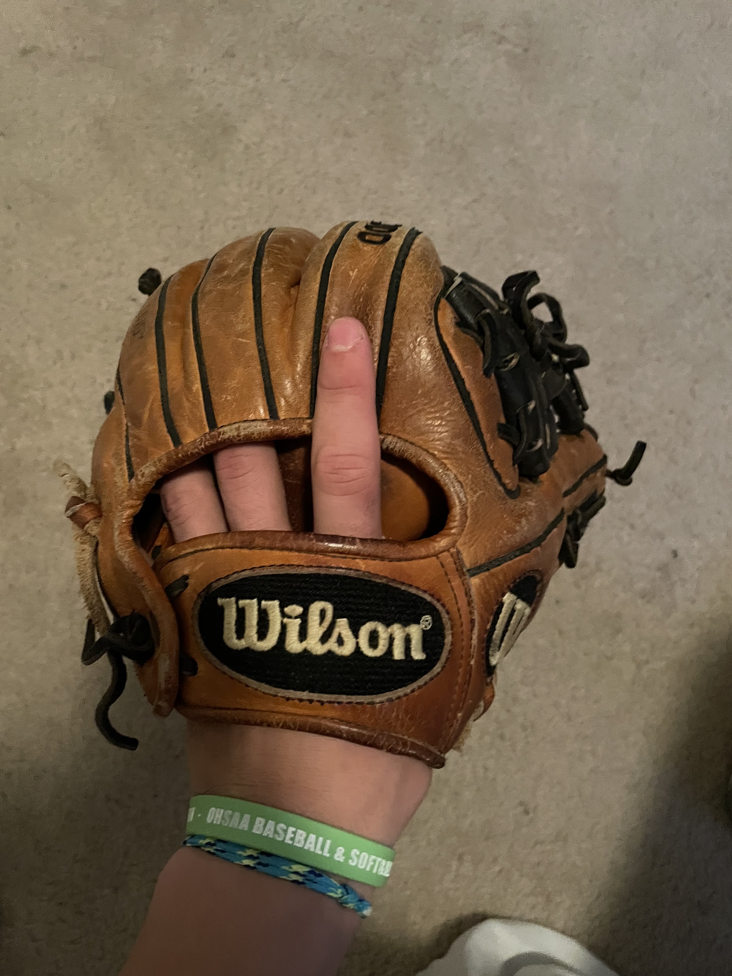 Infield 11.5" A2000 Baseball Glove | SidelineSwap